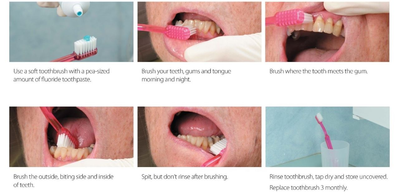 A guide to toothbrushing for carers • SA Dental
