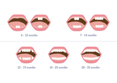 Baby teeth and teething • SA Dental
