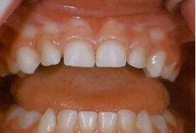 Lift the lip • SA Dental