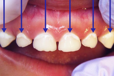 Lift the Lip Program • SA Dental