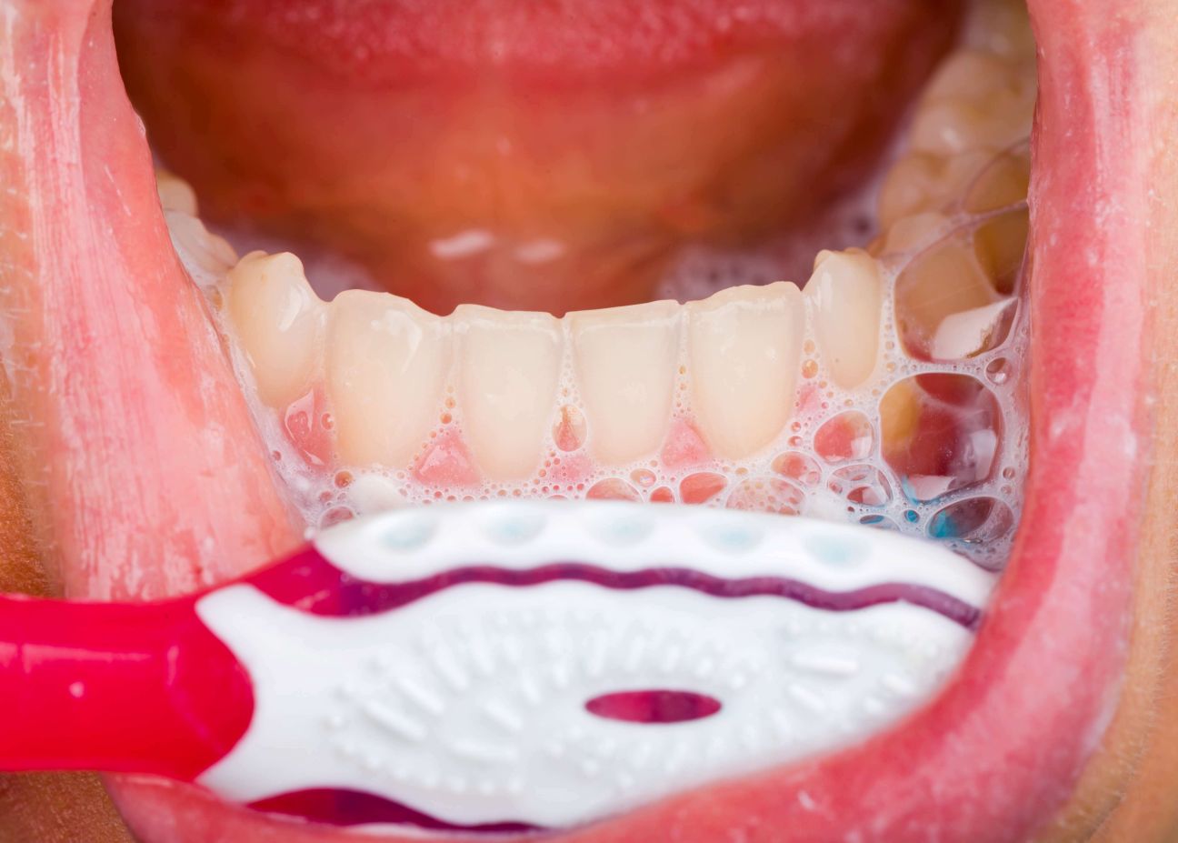 Common causes of toothaches • SA Dental
